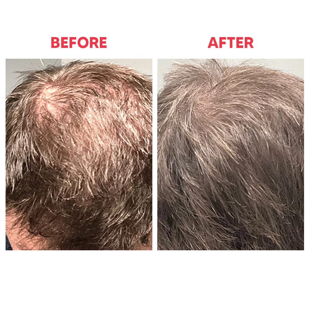 Hair Restore Shampoo For Men & Women - Hair Restoration Laboratories ...